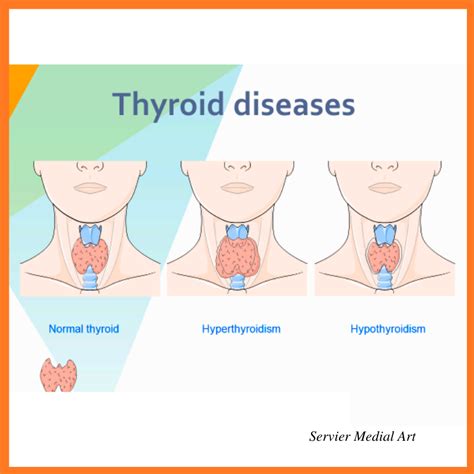 Normal Thyroid