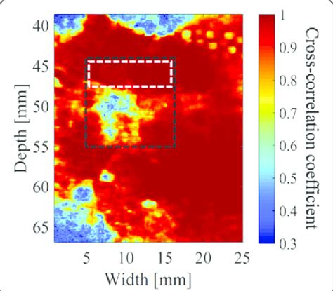 An Example Of Cross Correlation Coefficient Map After Hifu Exposure Download Scientific