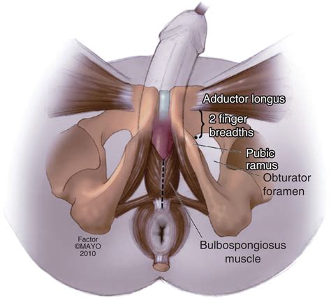 C165f003 Gif Abdominal Key