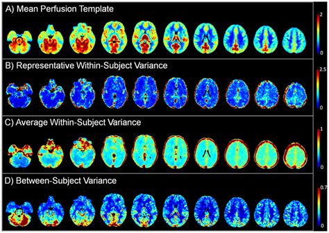Parameter Estimates For The Normal Perfusion Template Computed From