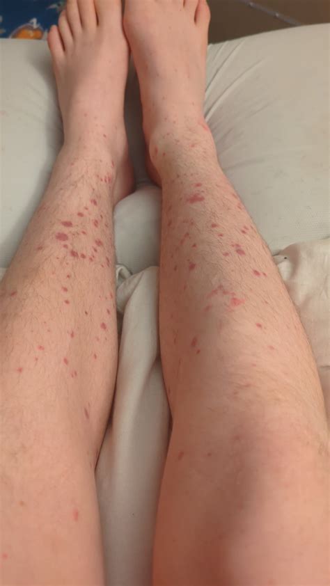 Weird Skin Condition Rskin