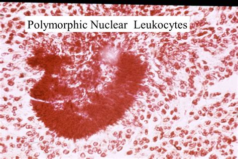 Diagnosis 1 Wet Mount 2 Skin Test 3 Serology 4 Fluorescent Antibody 5 Biopsy And