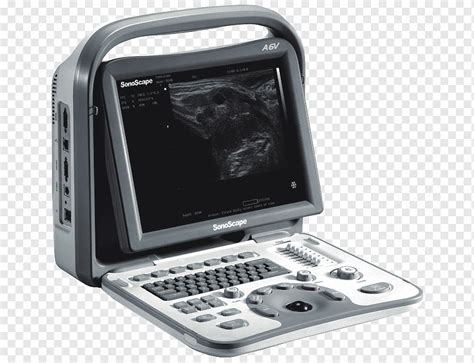 휴대용 초음파 초음파 촬영 도플러 심장 초음파 의료 진단 초음파 전자 제품 컴퓨터 모니터 액세서리 기타 Png Pngwing
