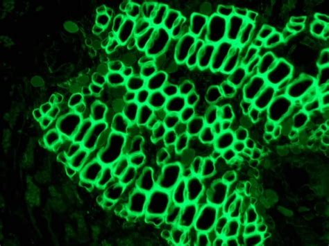 Olympus Ix83 Motorized Autofocus Inverted Fluorescence Microscope New Filters