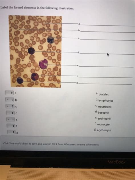 Solved Label The Formed Elements In The Following