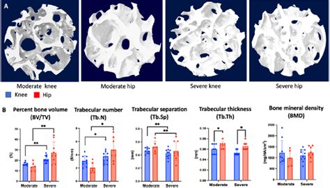 A Reconstructed 3d Models From Synchrotron Radiation X Ray