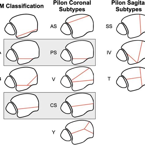 Masonmolloy And Topliss Classification Systems Utilised To Determine