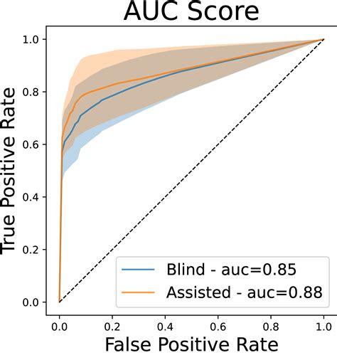 Ai Assisted Diagnosis For Covid 19 Cxr Screening From Data Collection