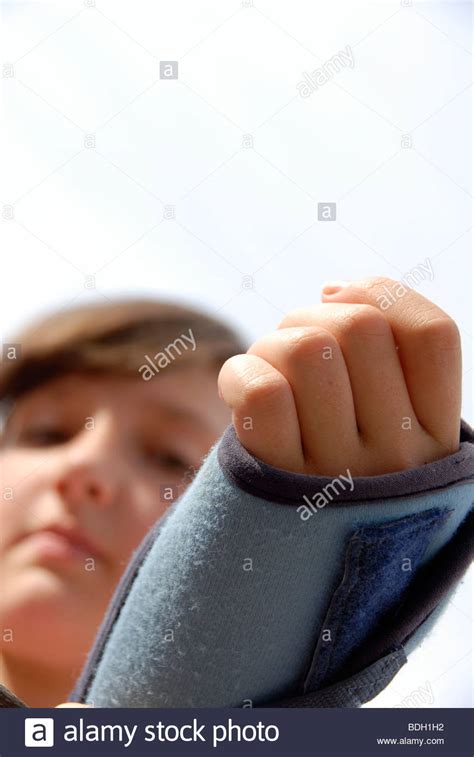Hand Splint Stock Photos Hand Splint Stock Images Alamy