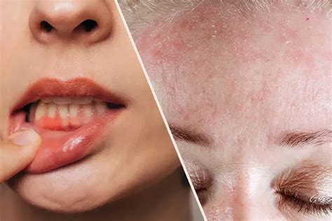 کمبود ویتامین سی چه علائمی دارد؟ عوارض بر پوست، مو و دهان