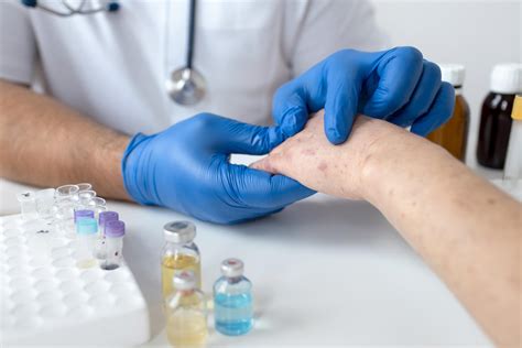 โรค แพ้ภูมิตัวเอง Sle โรค พุ่มพวง Tlc Udon Lab Center