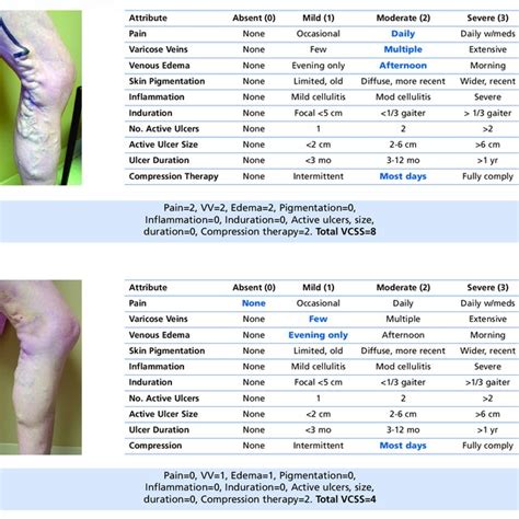 The Visual Language Of Vcss Consistency In Physician Scoring And Download Scientific Diagram