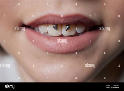 Upper Frenulum Piercing