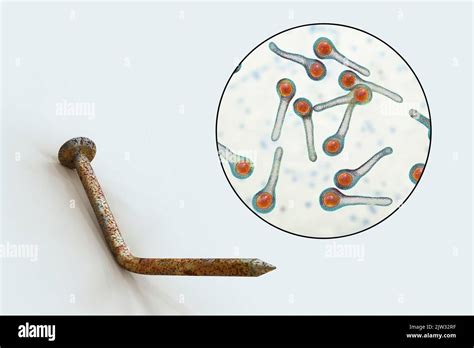 Transmission Of Tetanus Bacteria Conceptual Illustration Showing An Old Rusty Metal Nail As A