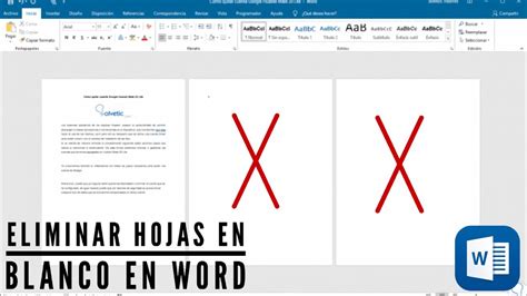 Eliminar Hojas Blancas En Word At Vivian Donnelly Blog