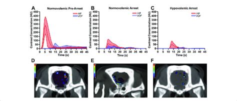 Arterial Input Function Aif And Venous Output Function Vof Curves Download Scientific