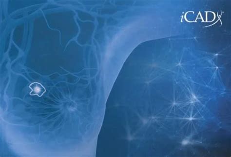 Fda Clears Ai Powered Breast Cancer Detection Tech From Icad Start Medical Product Development