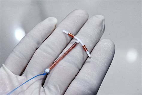 The Shocking DIY IUD Removal Trend