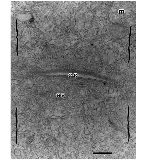 Fixed And Embedded Section Taken From A Series Of Serial Sections Of A Download Scientific