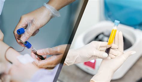 Unveiling PRP The Science Behind Its Surge In Popularity AD Surgical