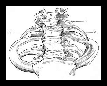 Cervical Neck Rib Cervical Rib A Barrier To Supraclavicular Brachial