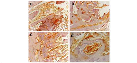 Immunohistochemical Stained Slides Of Osteocalcin Protein A Control Download Scientific