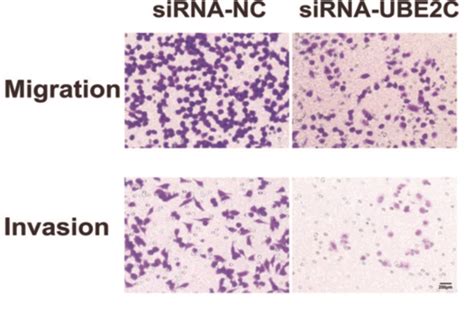 功能验证之transwell实验 知乎