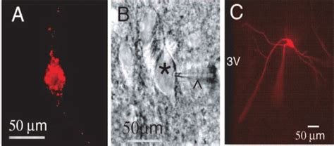 Identification Of A Retrogradely Labeled Spinally Projecting Pvn