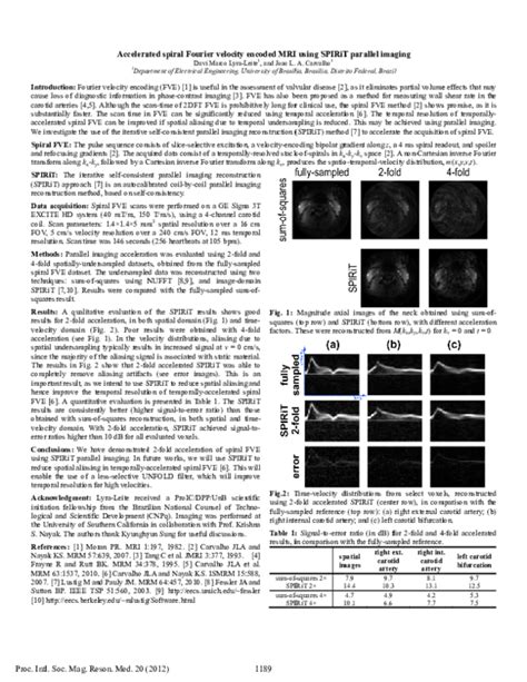 Pdf Accelerated Spiral Fourier Velocity Encoded Mri Using Spirit