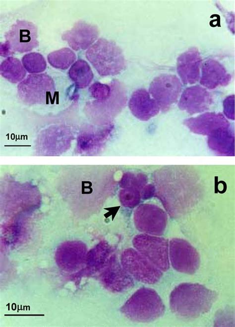 Blast Cell Morphology After 5 Days Of Incubation In Serum Free Medium