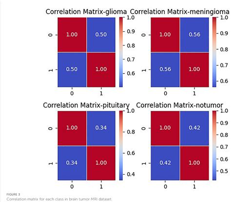 Figure 3 From A Fine Tuned Vision Transformer Based Enhanced Multi Class Brain Tumor
