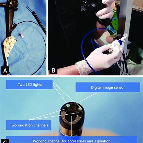 Single Operator Cholangioscopy Soc Using The Spyglass Ds System