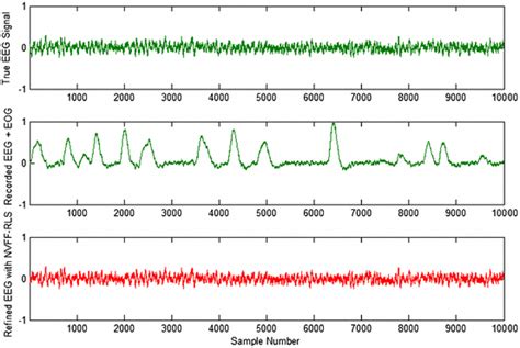 Refined Eeg Signal Red Colored At The Output Of Nvff Rls Based
