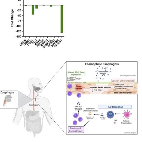 Unique Expression Of Muc Genes In Eoe Samples A Gene Expression Of
