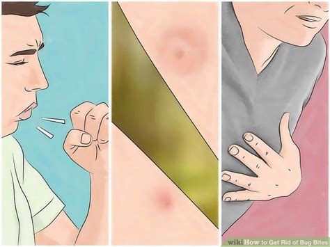 4 Ways To Get Rid Of Bug Bites WikiHow