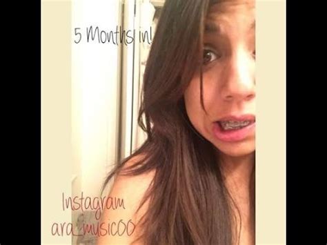 Adult Braces Update YouTube