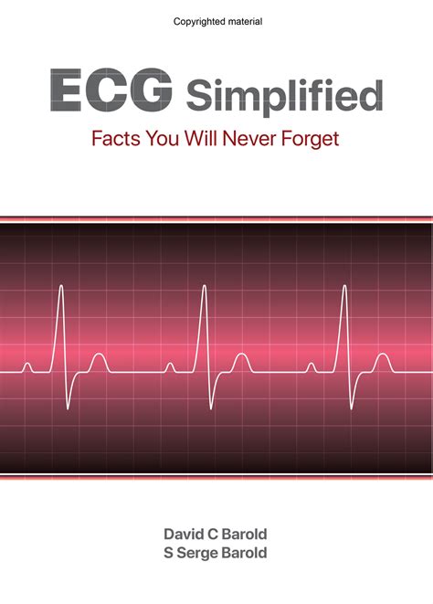 Electronic Ecg Book At Josephine Hinkle Blog