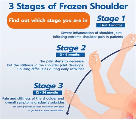 Frozen Shoulder Causes Symptoms And Effective Treatments Jack