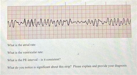 Solved What Is The Atrial Rate Chegg Com