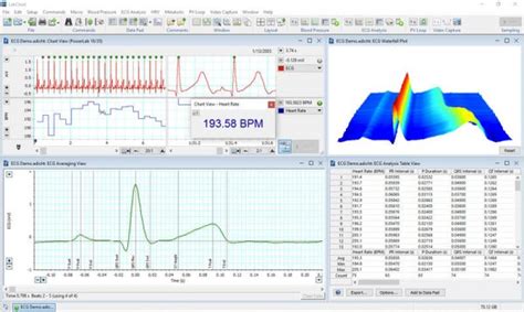 Labchart Analysis MODULES POWERFUL Data Interpretation Made Simple AdvanceTech Private Limited