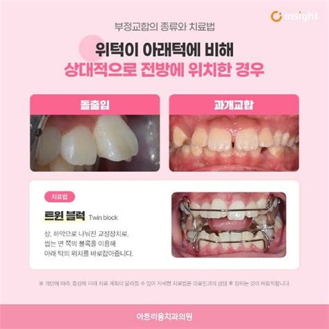 치과 카드뉴스 In 2024