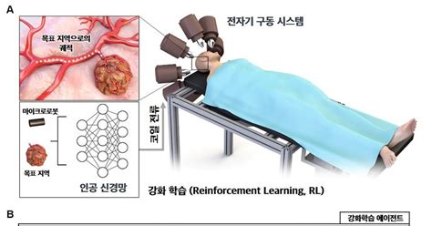 의료용 마이크로로봇 사람 몸 속에서 정밀 제어