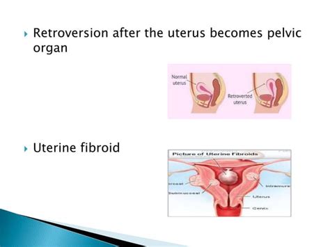 Subinvolution Of The Uterus Pptx