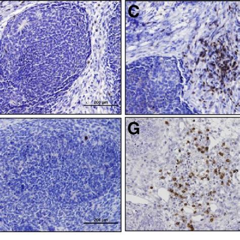 Proportions Of Various Inflammatory Immune Cells Infiltration Into