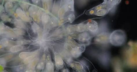 Free Stock Videos Of Rotifera Stock Footage In 4k And Full Hd