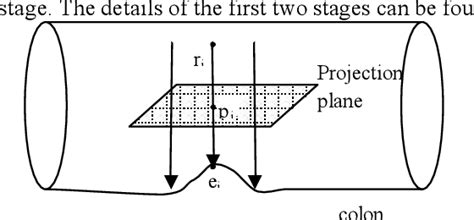 Figure 2 From Ct Colonography Computer Aided Polyp Detection Using Topographical Height Map