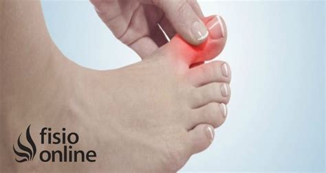 Necrosis Qu Es Caracter Sticas En Qu Patolog As Aparece Por Qu Y C Mo Se Produce