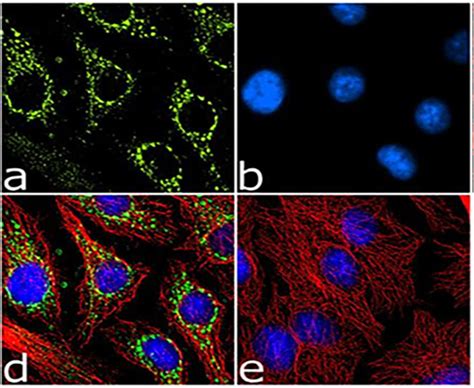 Recombinant Rabbit Monoclonal Antibodies Creative Diagnostics