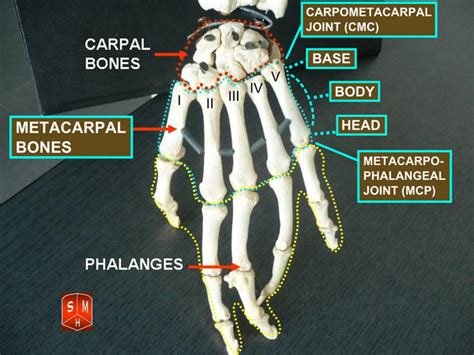 Metacarpal Bones Wikism Sports Medicine Wiki