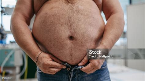 과체중 환자의 복부 클로즈업 뚱뚱한 남자의 허리 둘레가 높고 뱃살이 뚱뚱하다 과폭과 비만의 건강 위험 개념 심장 질환에 대한 스톡 사진 및 기타 이미지 Istock